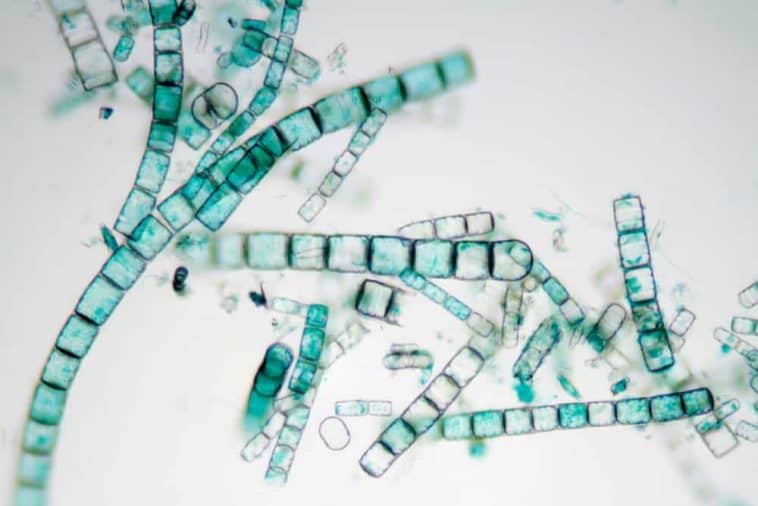 10 Different Types of Protists – Nayturr